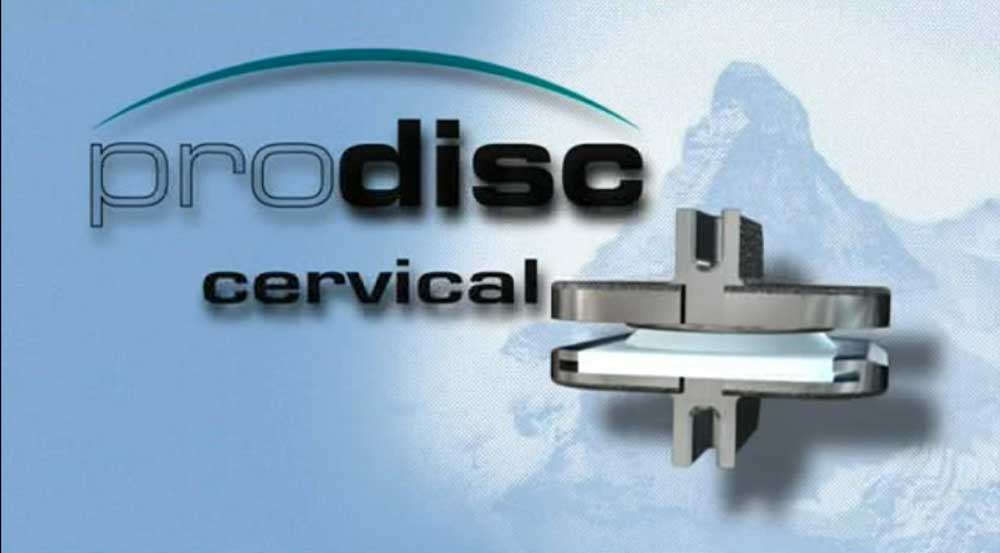 ProDisc-C Disc Replacement Surgery : New York Cervical Spine Specialist