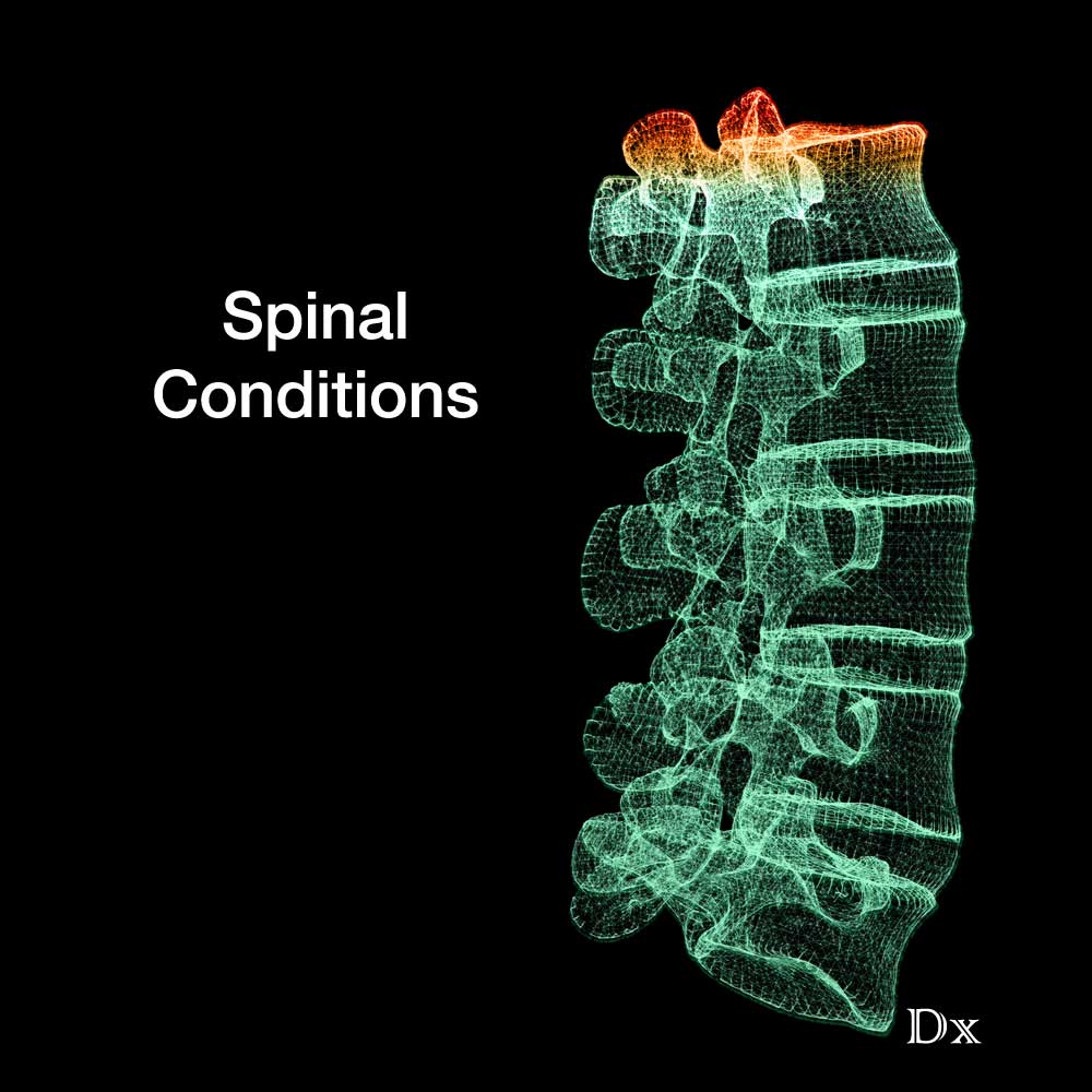 Spinal Conditions : New York Spine Surgeon